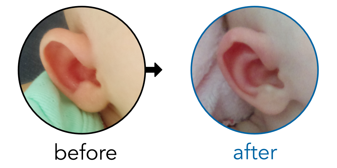 Elyse & her Daughter – EarBuddies