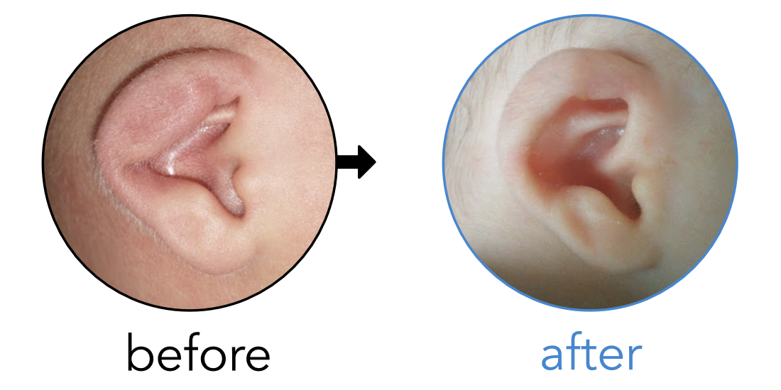 Laura & her Son George – EarBuddies