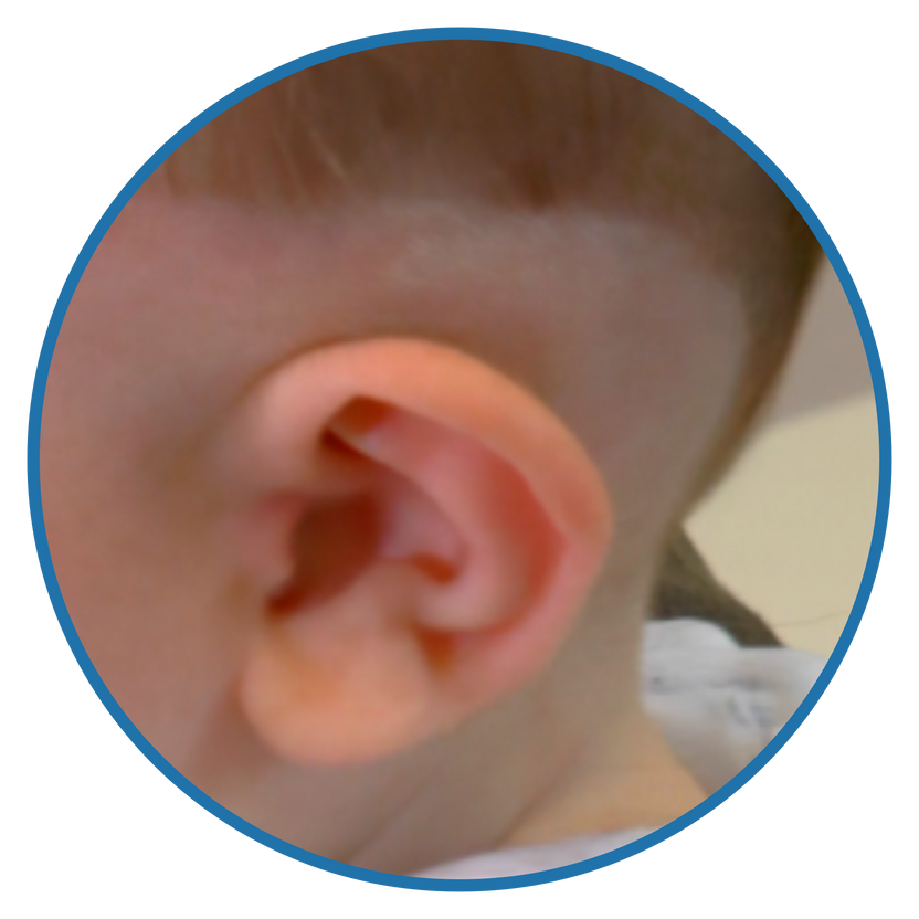 Fitting guide – EarBuddies